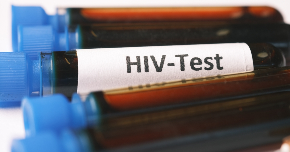 Japan's HIV test market to reach US$58m in ten years | Healthcare Asia ...