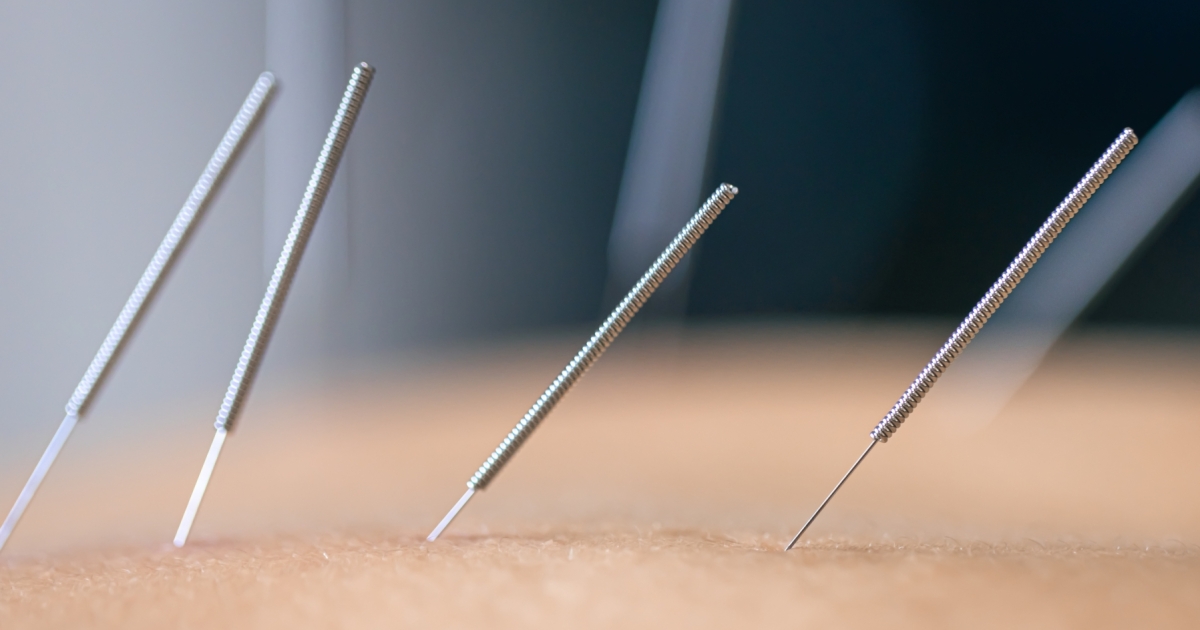 Acupuncture market CAGR to climb 14.09% until 2027 | Healthcare Asia ...