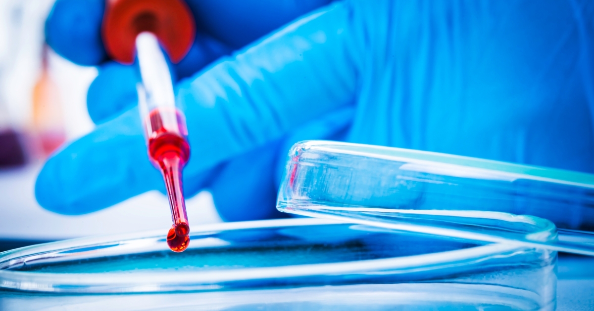 Liquid biopsy market projects 25.2% CAGR growth until 2028 | Healthcare ...