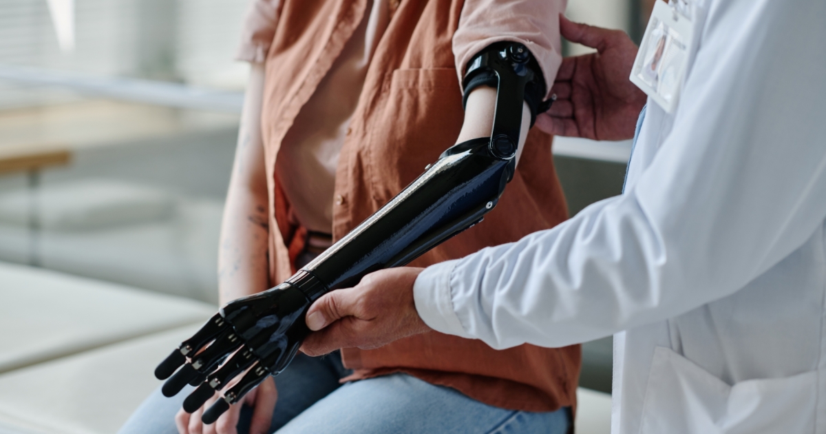 Prosthetic robot arm market to rise at 14.8% CAGR through 2028 ...