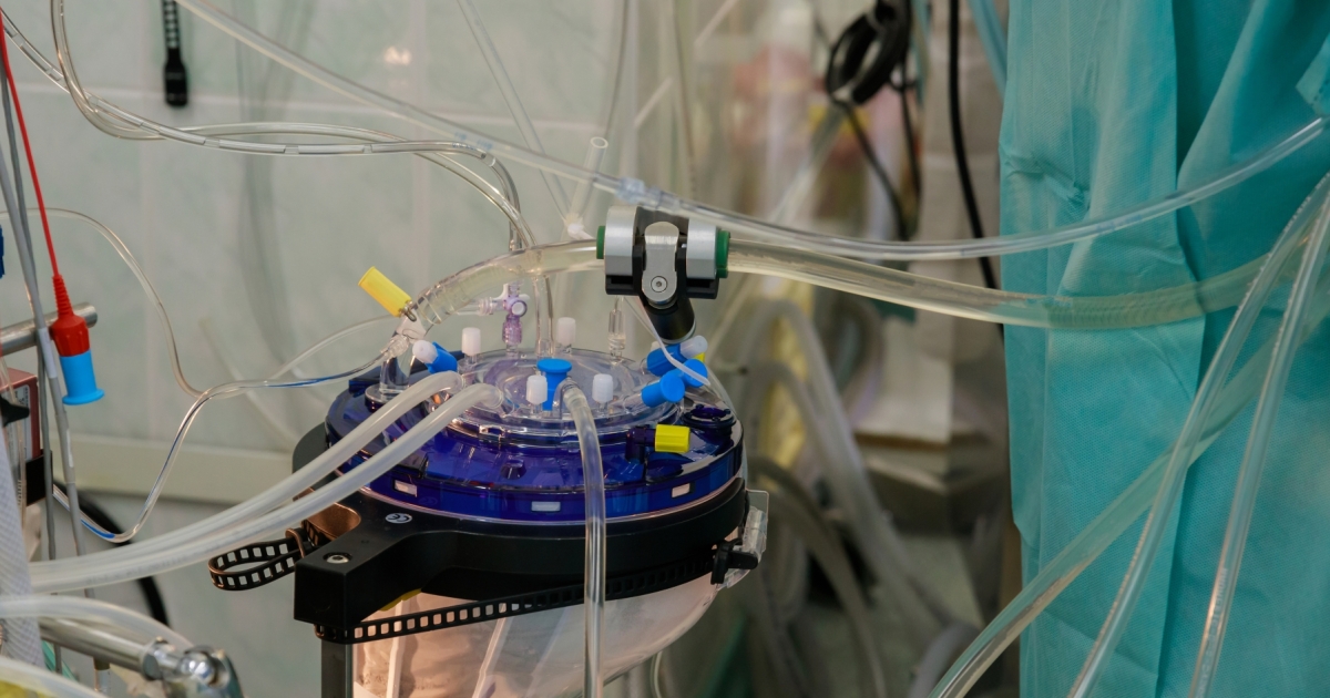 Australia unveils Kids ECMO Referral Service in New South Wales ...