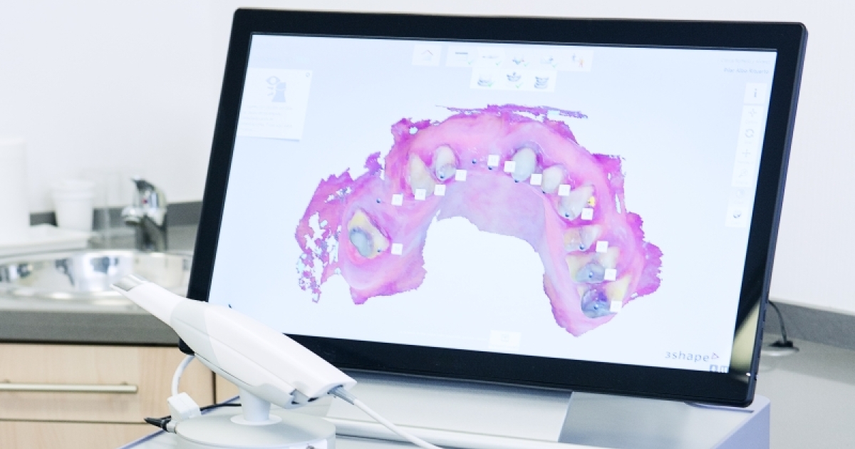 Global intraoral scanners market to rise by $915.8m by 2028 ...