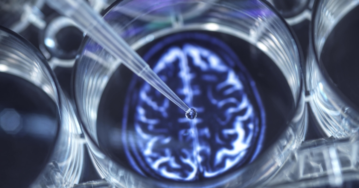 Digital neuro biomarkers market to be valued at 4.59b by 2032 ...