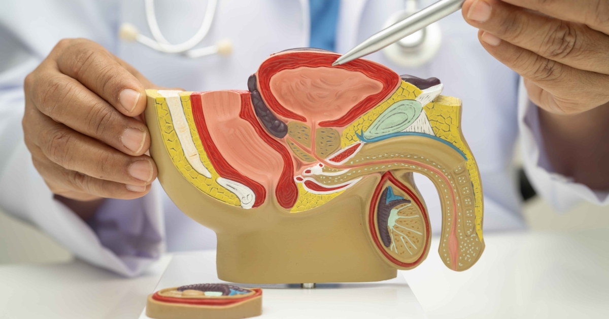 Mahkota Medical Centre unveils new PET-CT scan for prostate cancer | Healthcare Asia Magazine