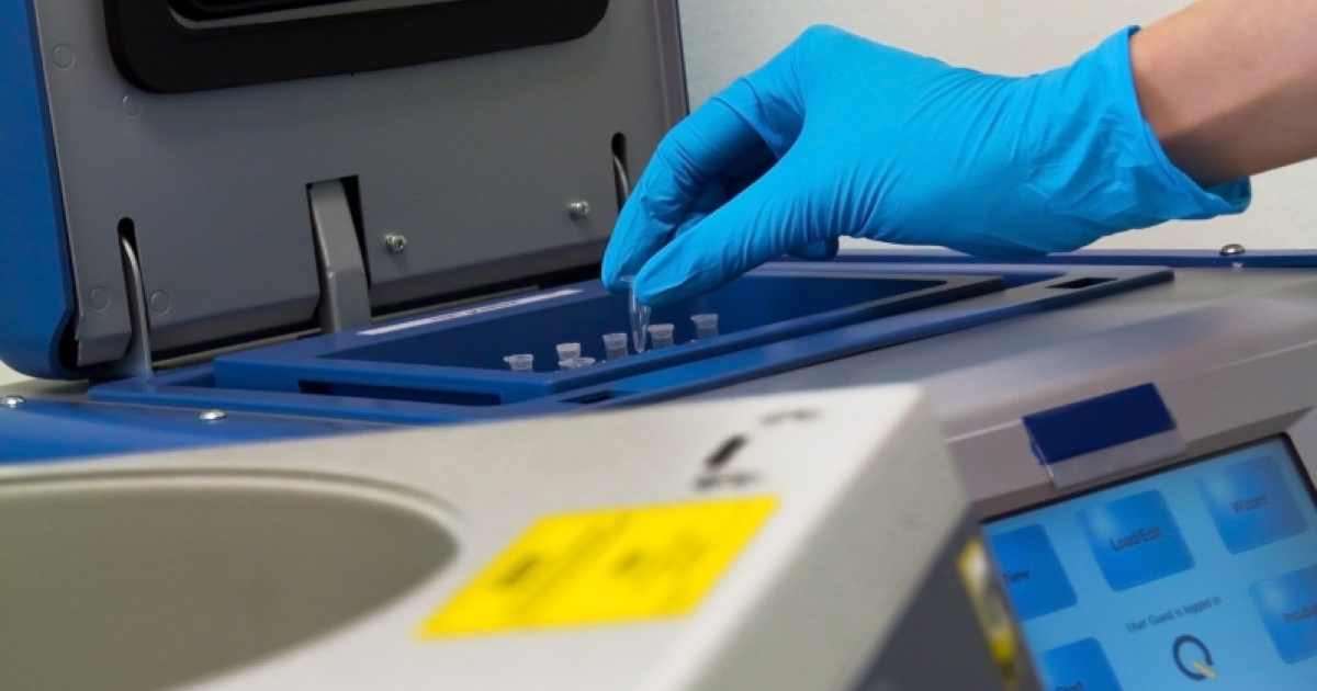 South Korea’s PCR systems market to grow at 4% CAGR through 2036 ...