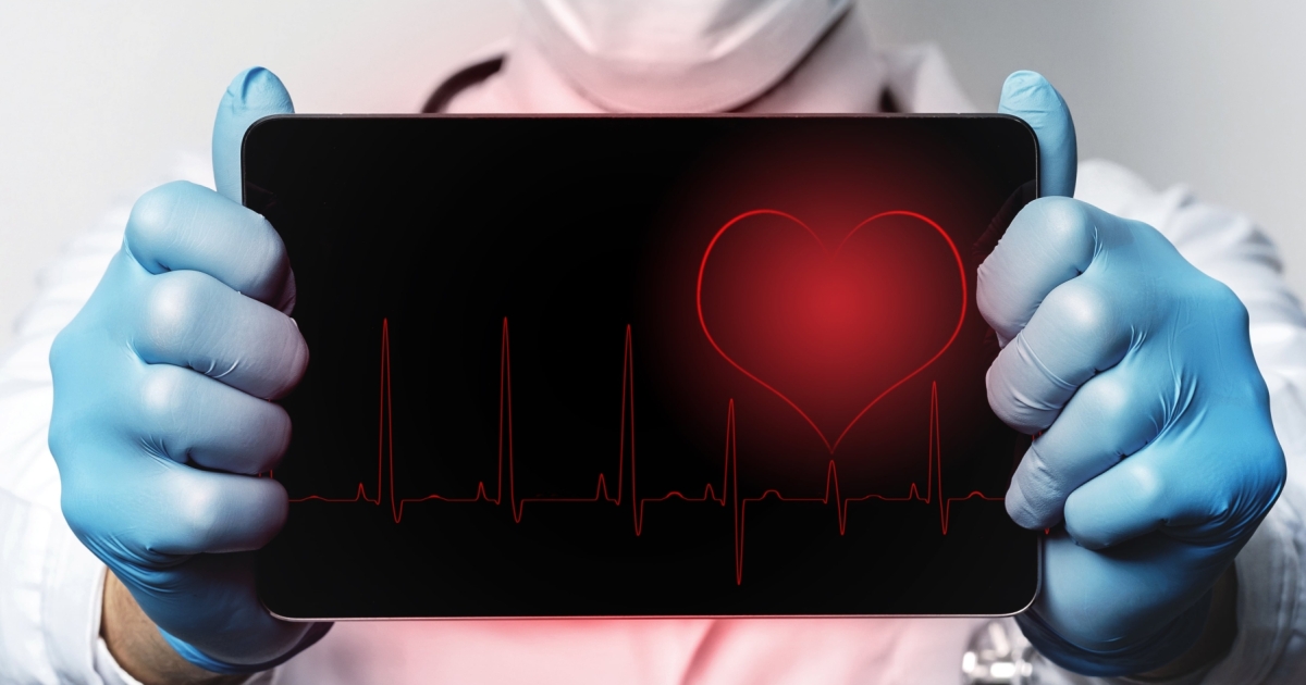 KPJ Kuching uses PulseSelect for Borneo’s first cardiac ablation ...