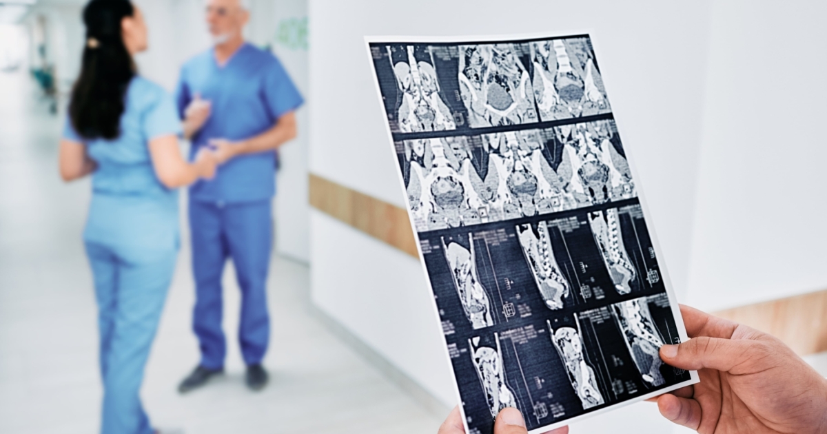 Tenders open for SCGH imaging upgrades, new CT scanner in Western ...