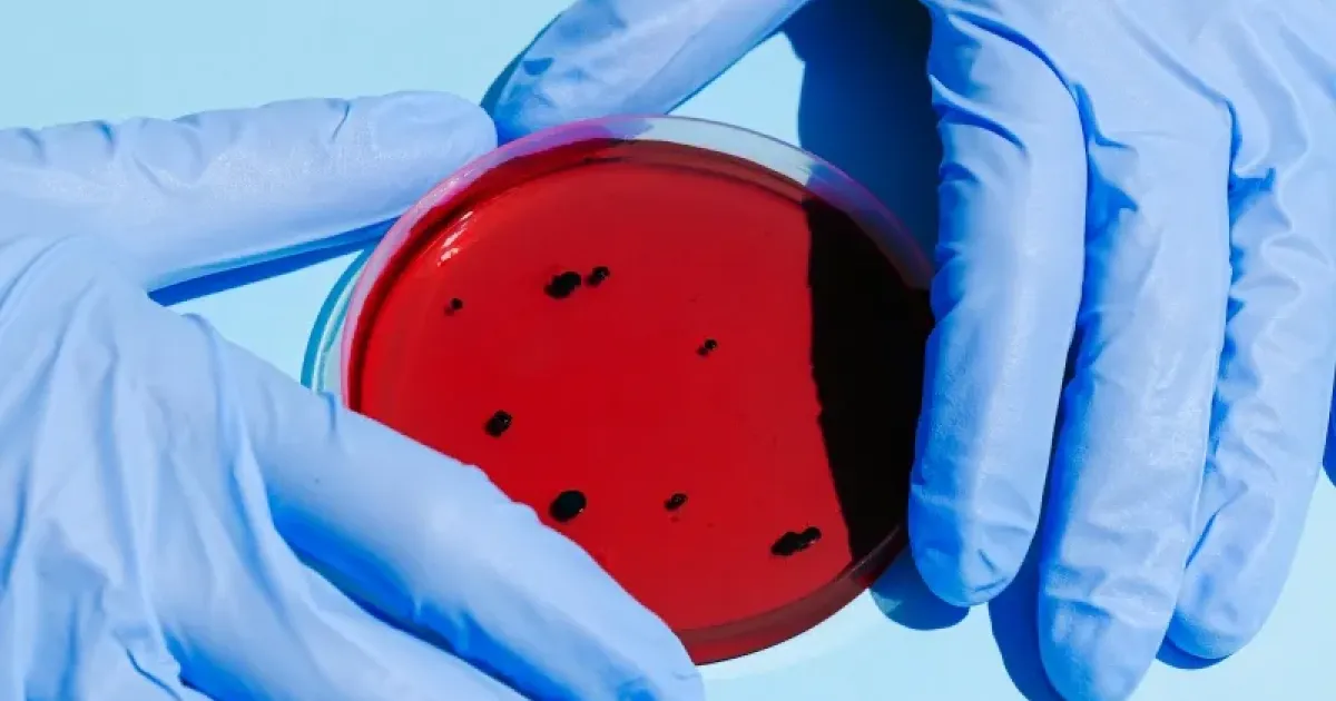 Infectious diseases, fast diagnostics drive clinical microbiology ...